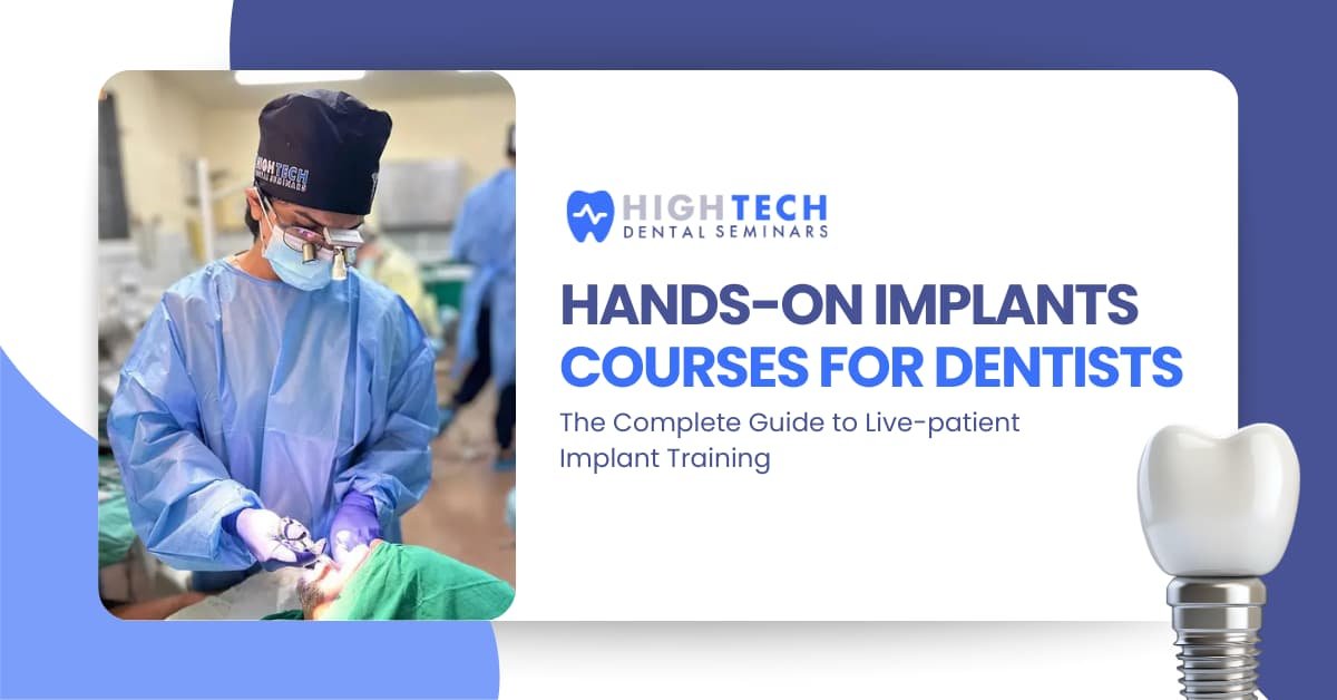 Hands-On Implant Courses for Dentists: Live Patient Training Guide | HTDS